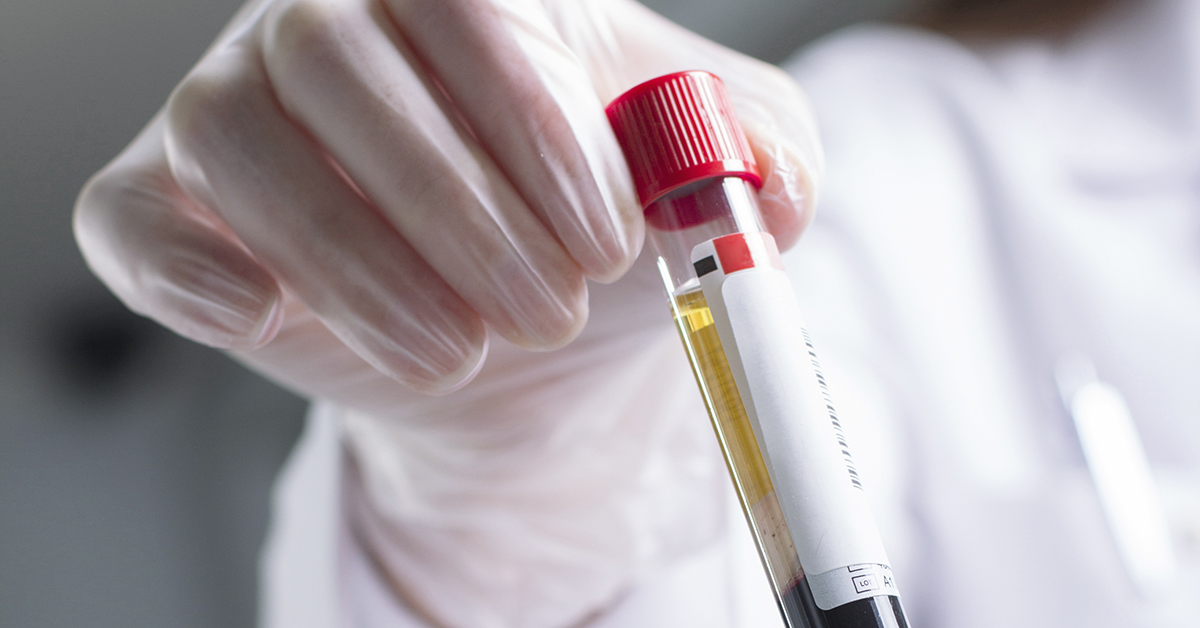 Blutbestandteile: Blutzellen und Blutplasma | BZgA Blutspende - BIÖG ...